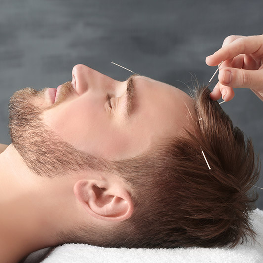 Acupuncture & TCM | Dr. Fatima Manji - Chiropractor